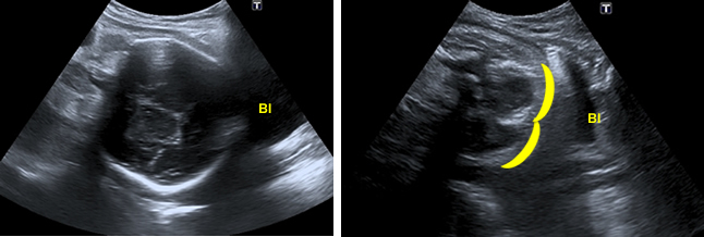Presentation on Ultrasound