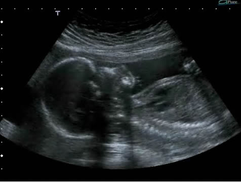 Technique for Performing BPD Measurement