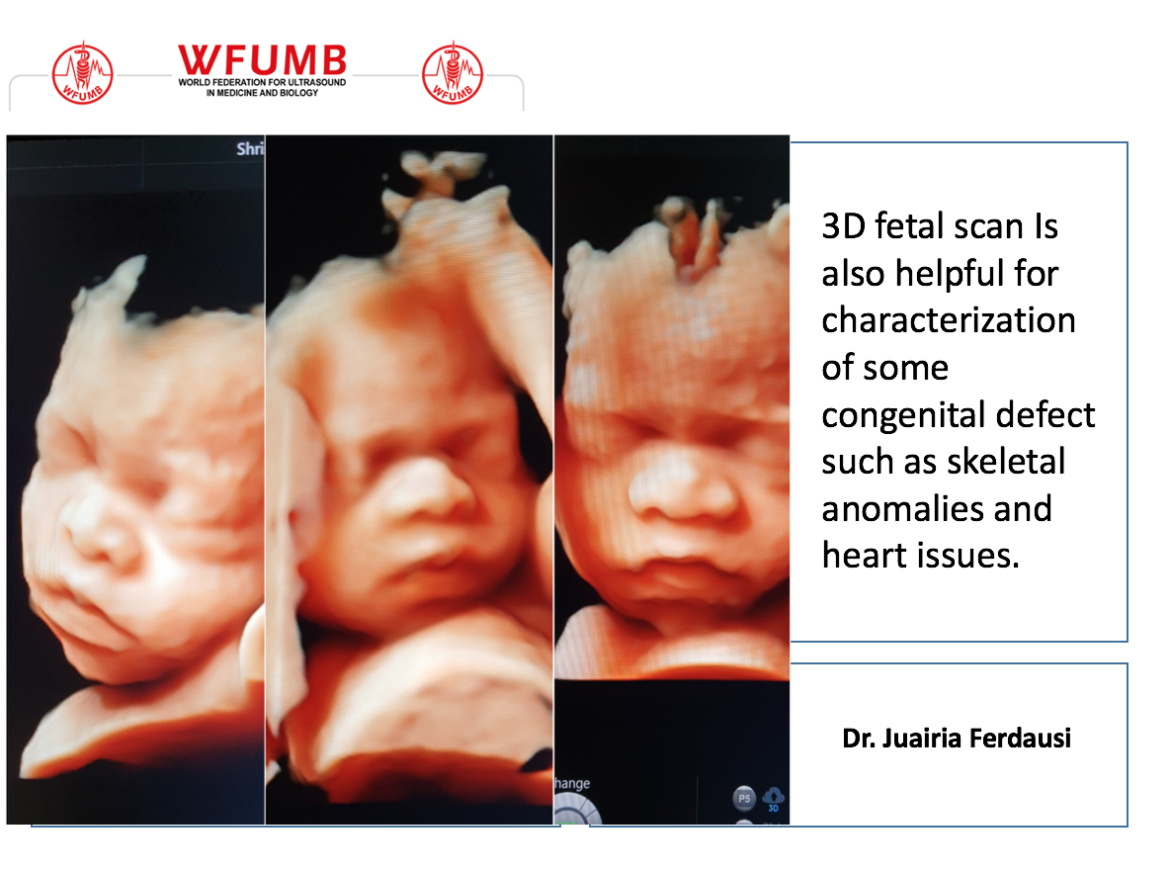 Ultrasound the Best #11: 3D Fetal Scan – WFUMB