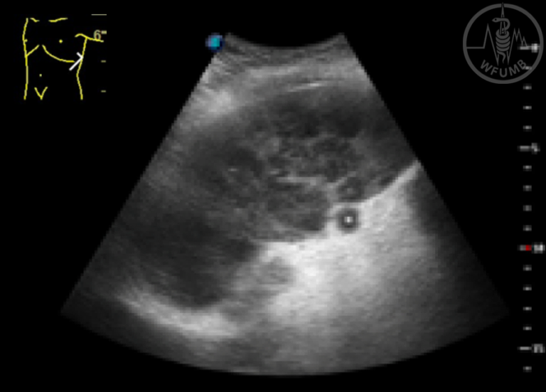 Spleen and Lymph Nodes – Chapter 16 Media Library – WFUMB
