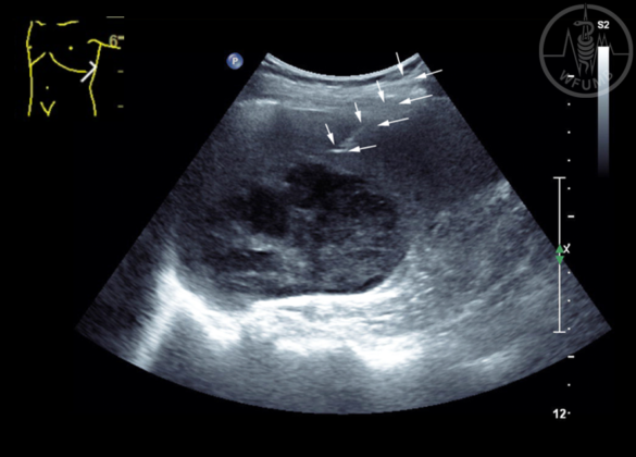 Spleen and Lymph Nodes – Chapter 16 Media Library – WFUMB