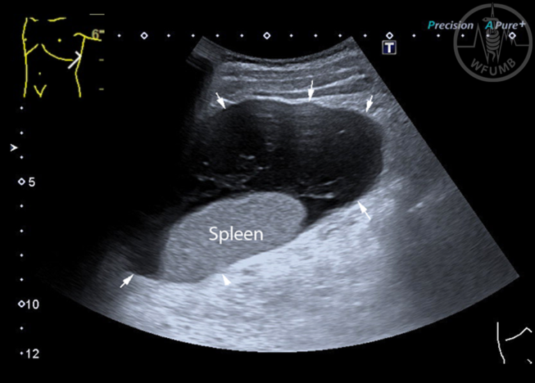 Spleen and Lymph Nodes – Chapter 16 Media Library – WFUMB