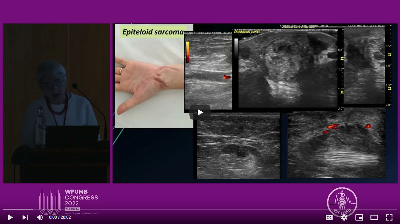 Tumors and tumors – like of the hand and fingers ~ Daniela Fodor ...