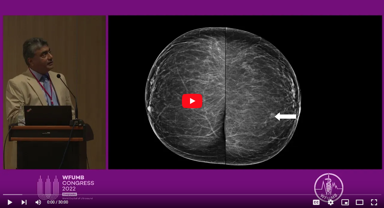 Using ACR BI-RADS Lexicon Ultrasound Descriptors in Clinical Practice ...