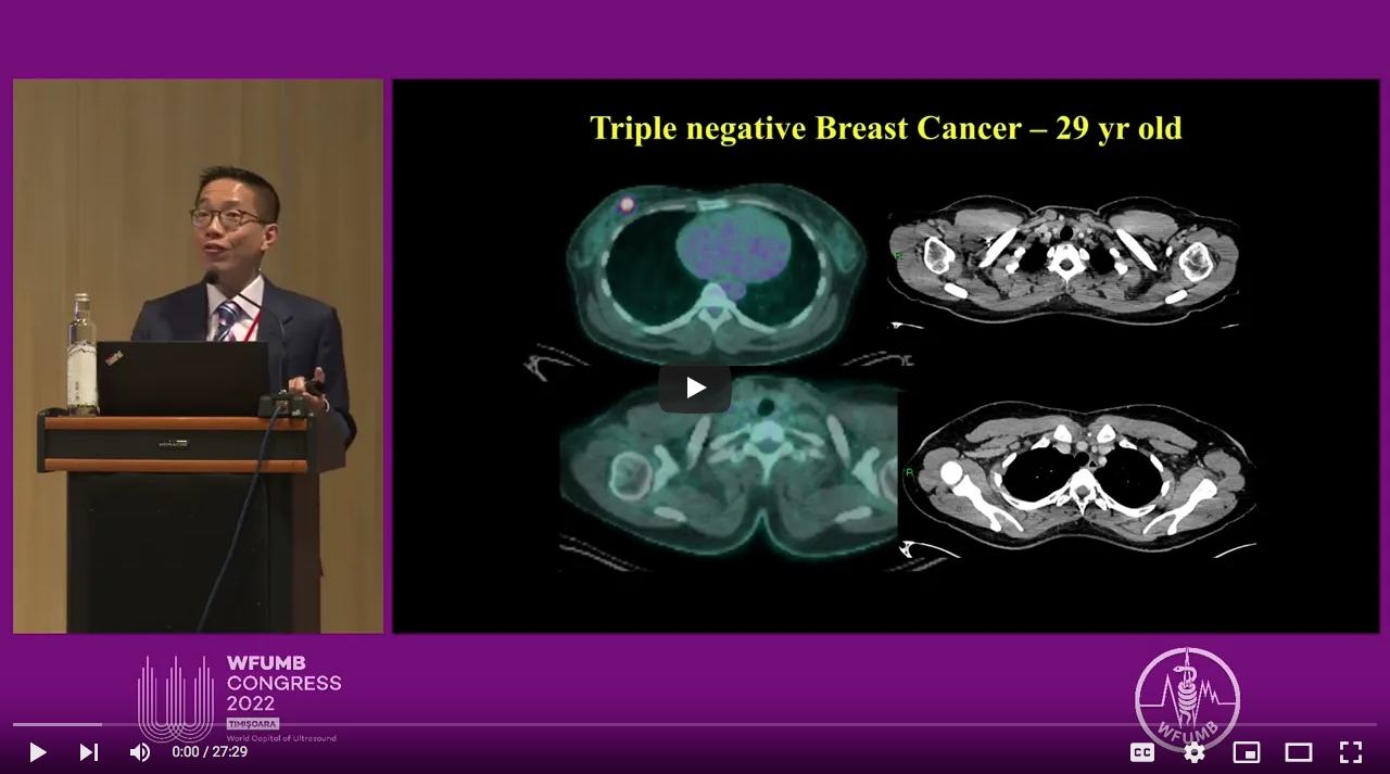 The clinical utility of advancing US technologies for breast imaging ...