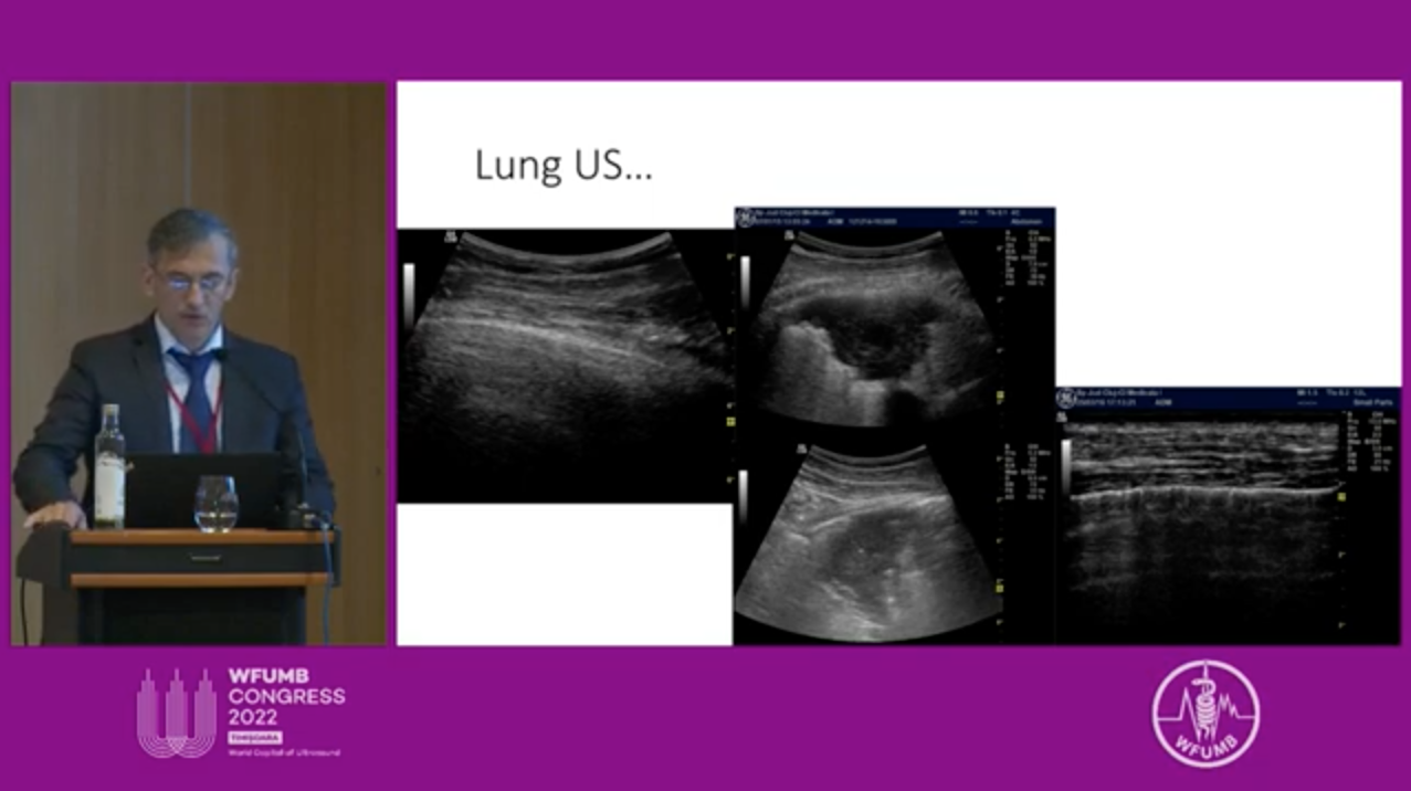 US Pulmonar – Artificial intelligence applications in focal and diffuse ...